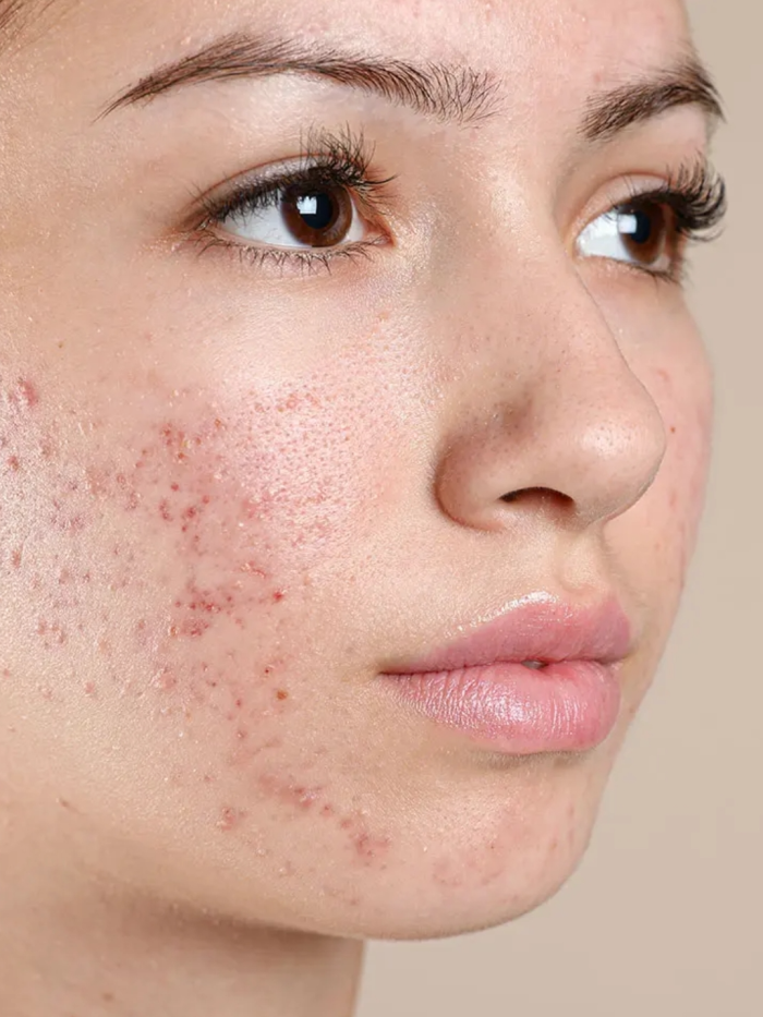 네이버 인플루언서